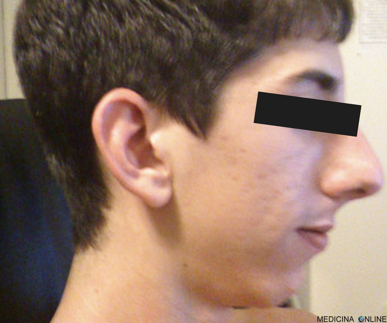 naso | MEDICINA ONLINE