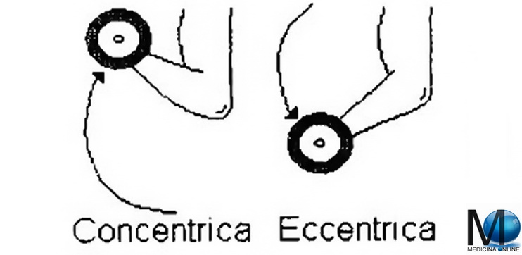 Differenza tra forza concentrica ed eccentrica | MEDICINA ONLINE