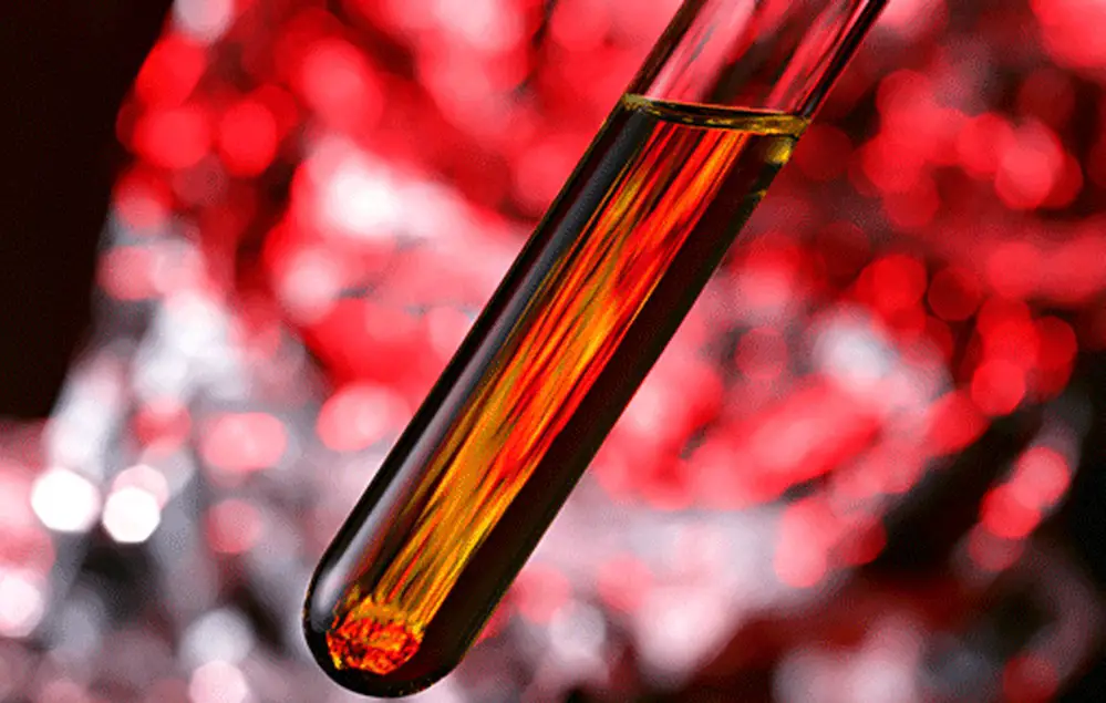 Emocromo completo con formula leucocitaria: valori, interpretazione e ...