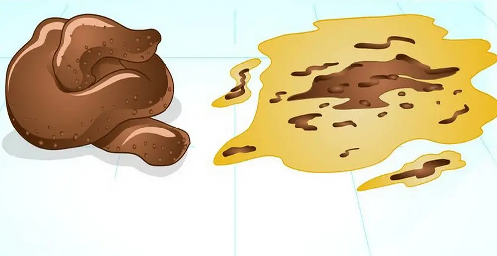 Colore delle feci: normale e patologico | MEDICINA ONLINE