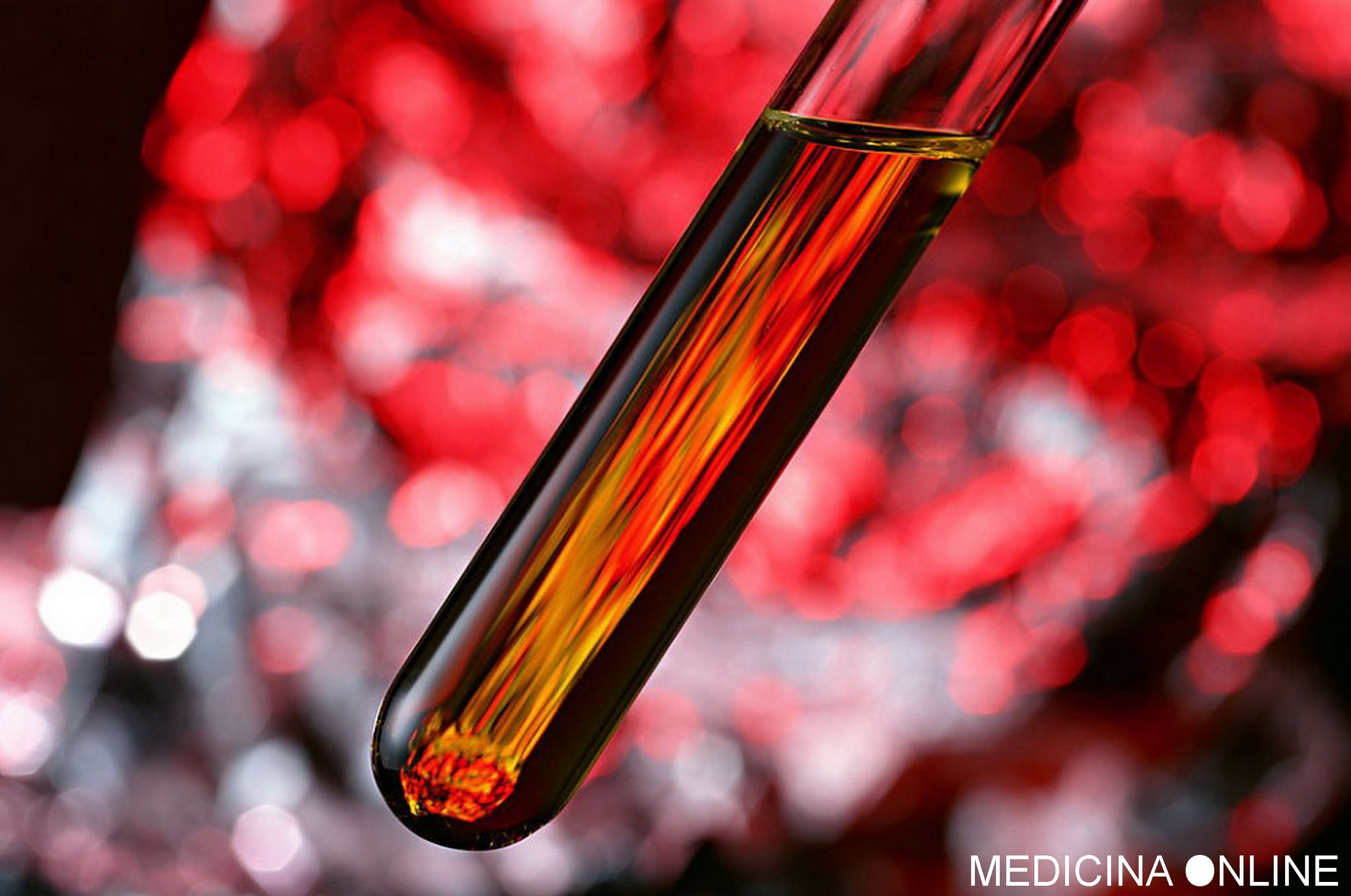 Plasma e cellule (elementi corpuscolati) che compongono il sangue ...