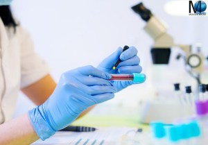 Piastrine: valori normali, funzioni, numero, alte e basse | MEDICINA ONLINE