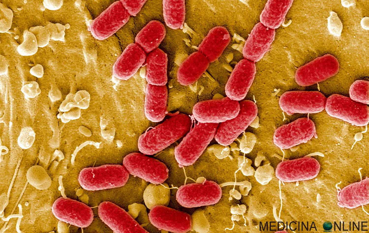 edema infiammatorio | MEDICINA ONLINE