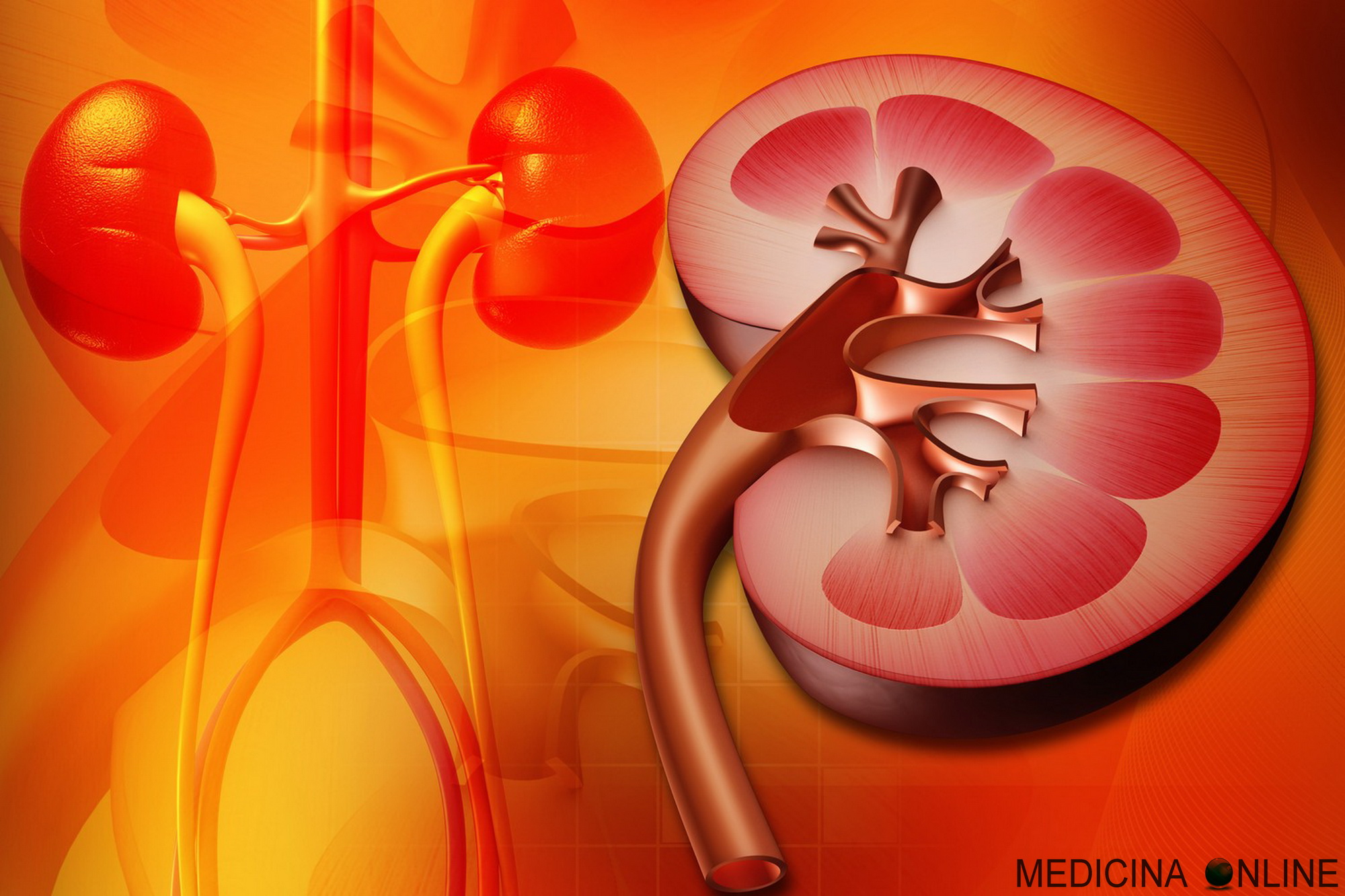 sindrome nefrosica | MEDICINA ONLINE