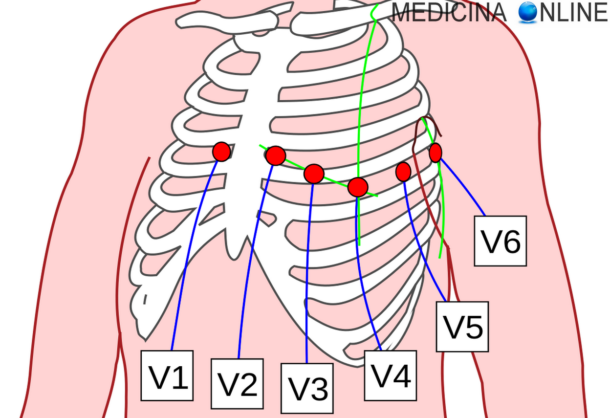 Elettrocardiogramma: procedure iniziali, posizionamento degli elettrodi ...