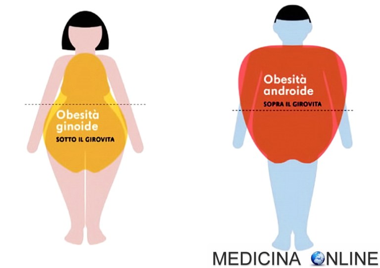 Differenza tra obesità androide e ginoide ed i rispettivi rischi per la ...