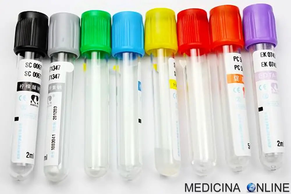 tappo | MEDICINA ONLINE