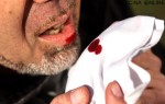 Emottisi: cause, cosa fare, massiva, significato e terapia | MEDICINA ...