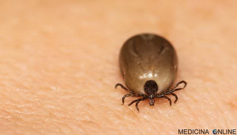 Punture di insetti: come riconoscerle ed intervenire | MEDICINA ONLINE