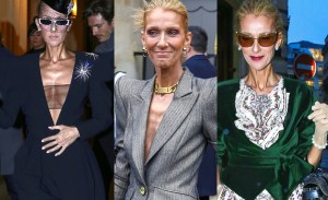 SPR: cos’è la rarissima malattia che ha colpito Céline Dion? | MEDICINA ...