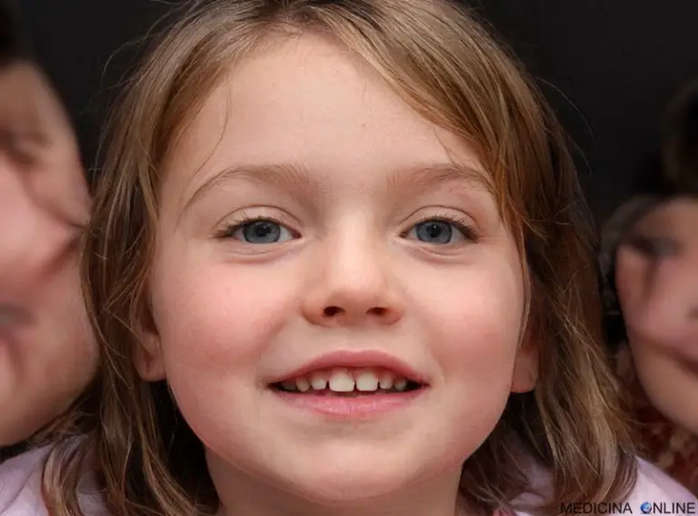 Denti da latte (decidui) nei bambini: quando spuntano e cadono ...